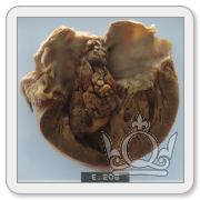 QMUL Virtual Pathology Museum